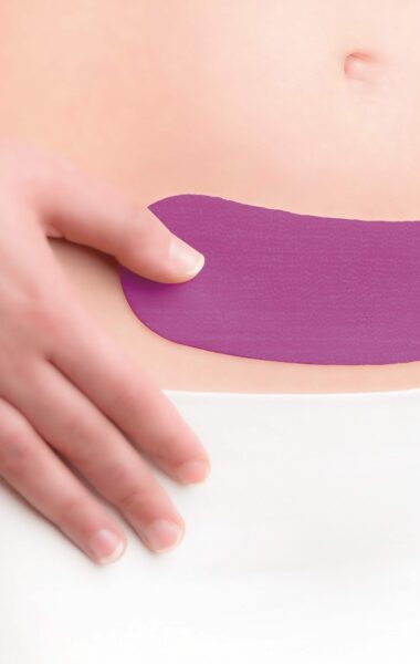 Keizersnede herstel met Scarban C-section - BAP Medical B.V.
